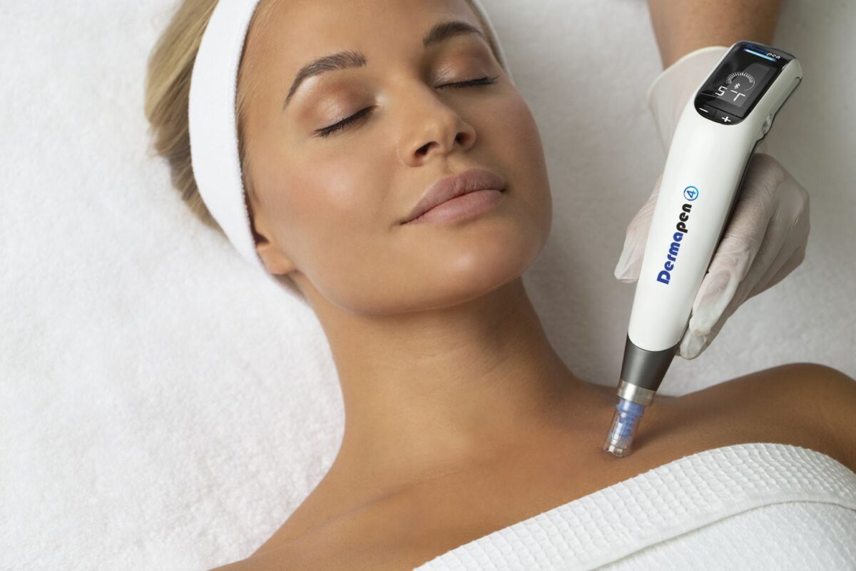 8 Incredible Benefits of Microneedling for Your Skin