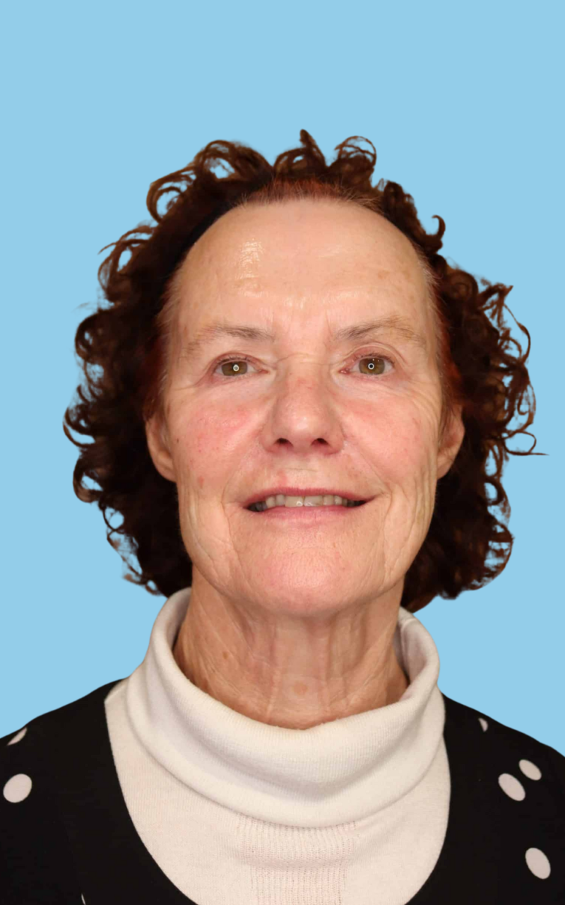 Meet Chrissie who was a non-surgical facelift model at our workshop ...