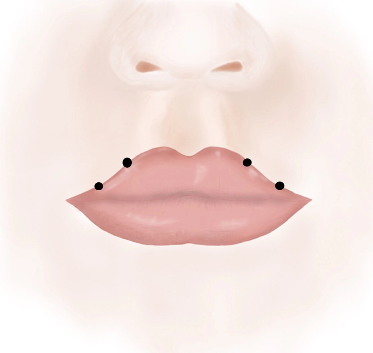 Botox For Lips-How Does it work