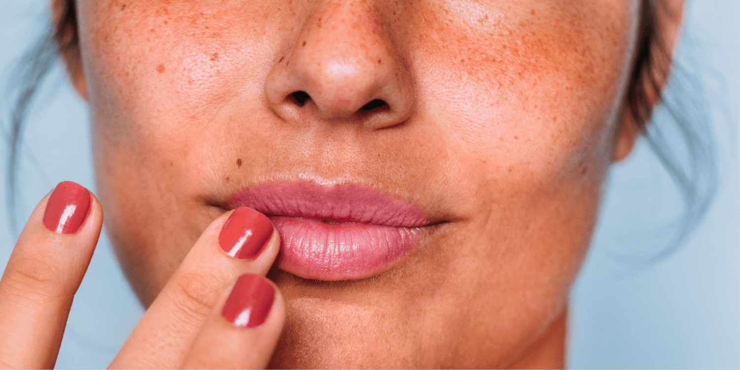 Botox Mouth Corner Lift | Satini Cosmetic Clinic