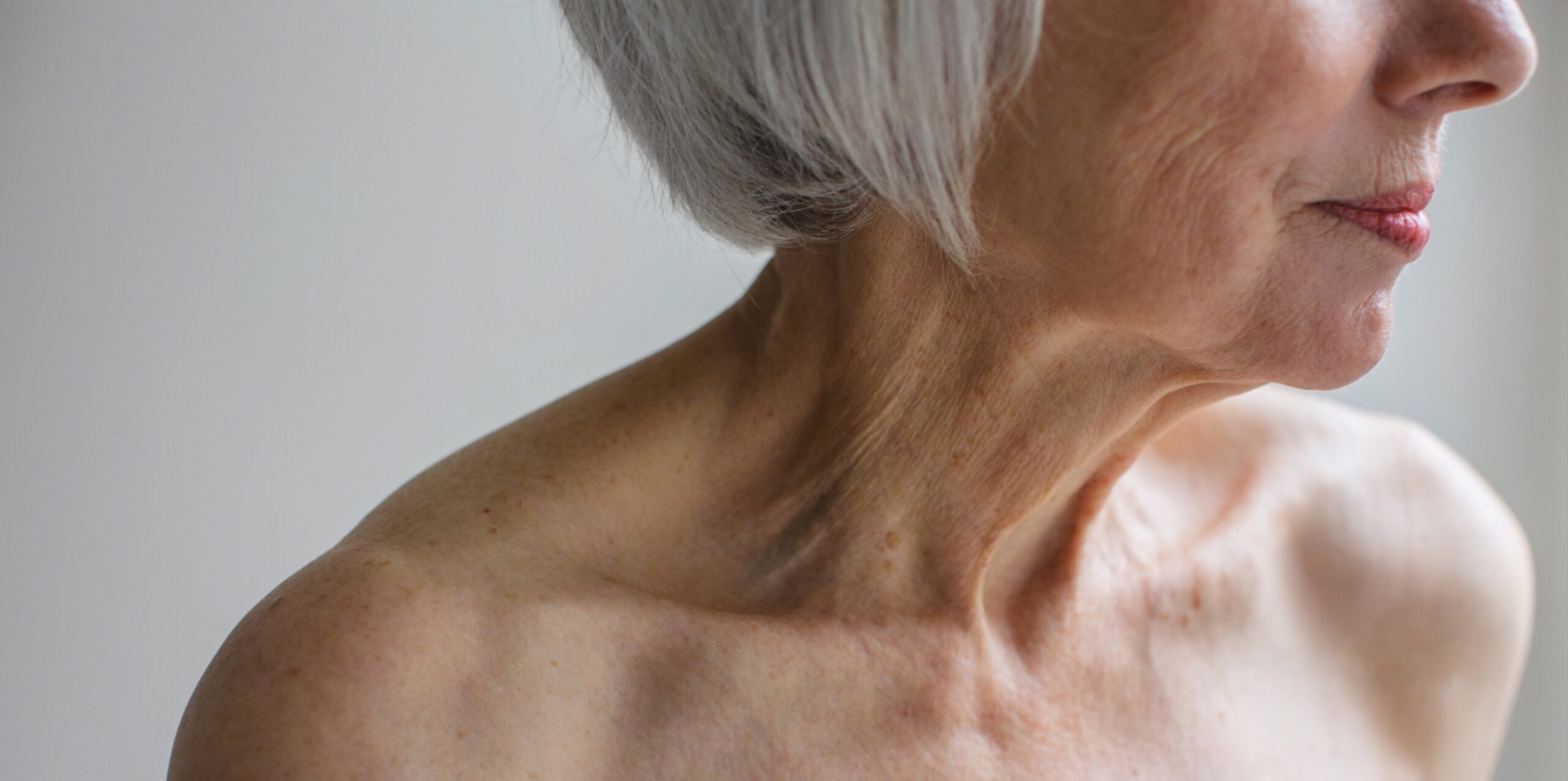 Neck Wrinkles | Satini Cosmetic Clinic